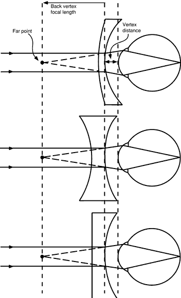 Volume 1, Chapter 51A. Spectacle Lens Powers